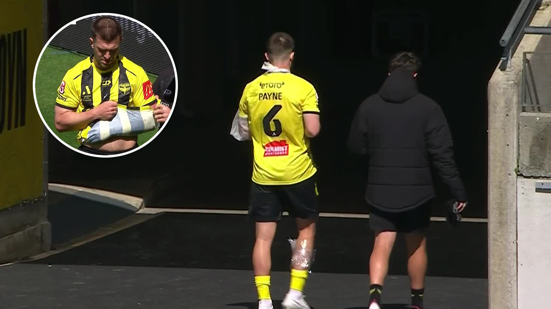 A-League injury news: Phoenix star suffers broken collarbone